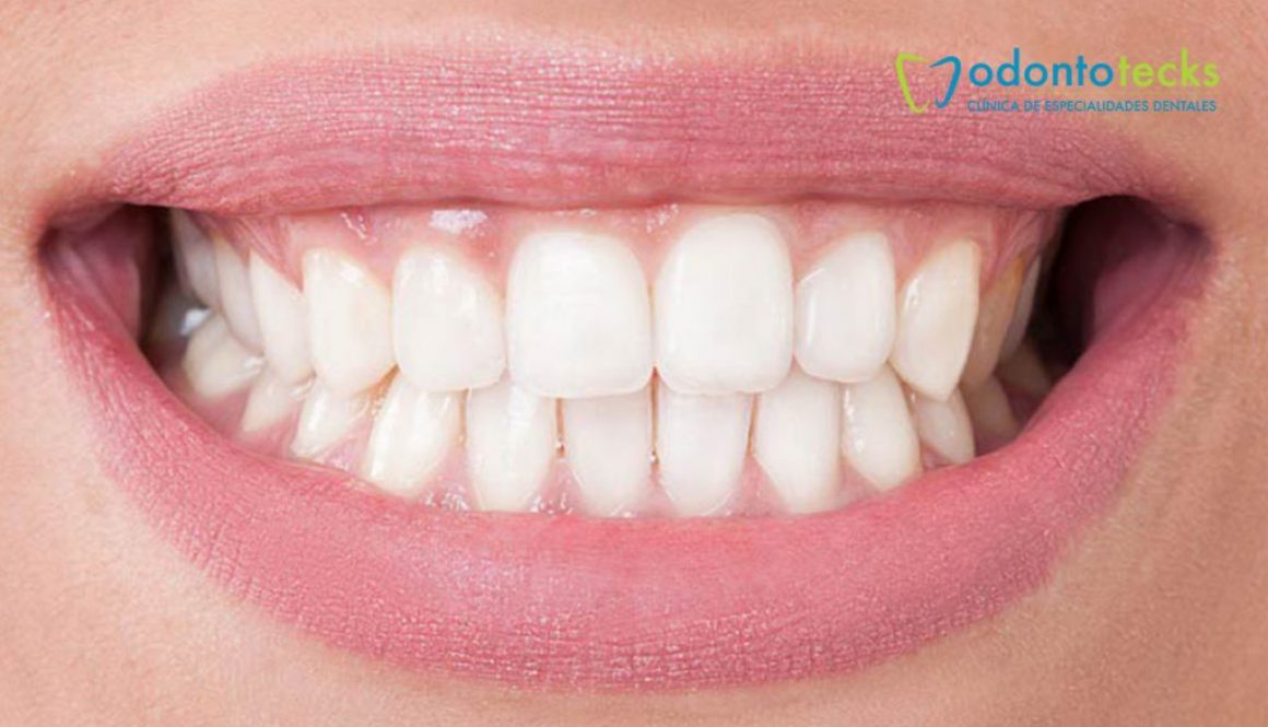 oclusión dental | Odontotecks